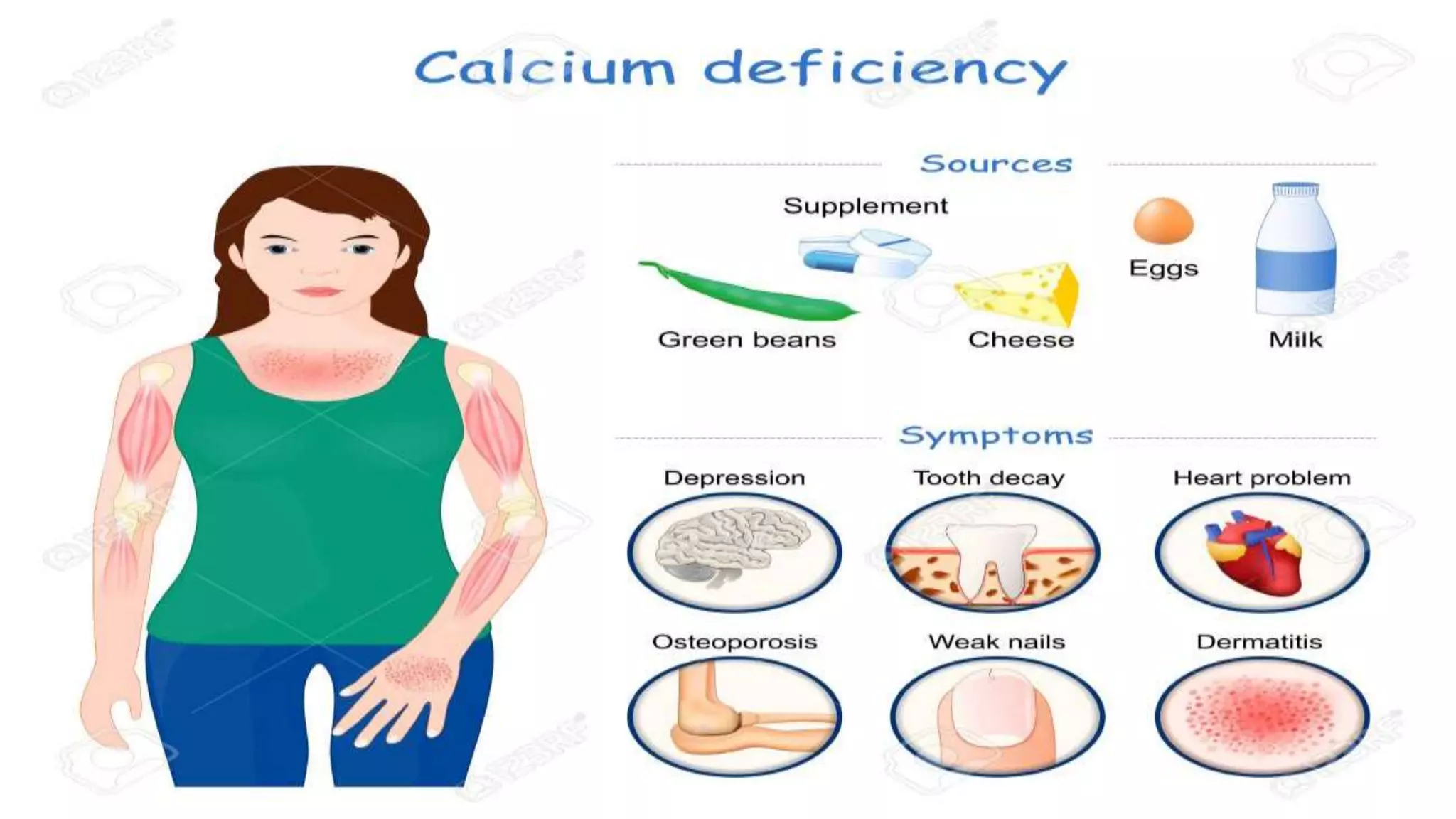 Minerals deficiency-SOURABH SARDHANA | PPTX