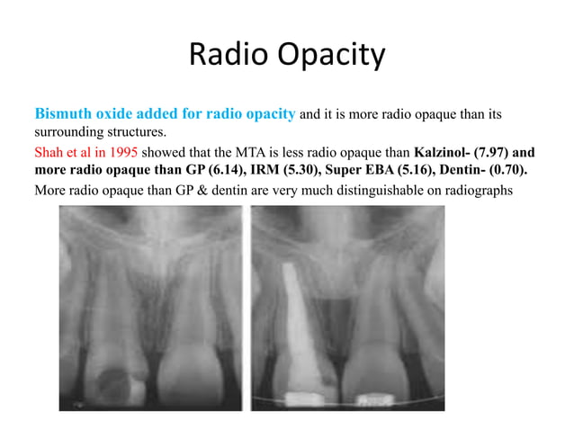 Mineral trioxide aggregate | PPTX | Dental Health | Diseases and Conditions