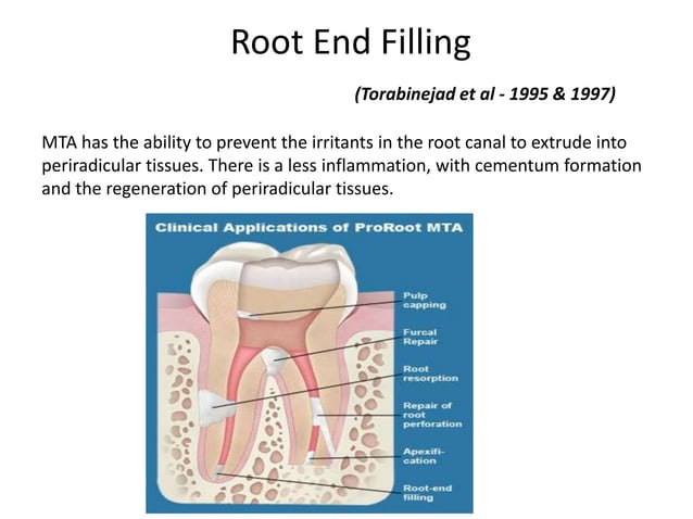 Mineral trioxide aggregate | PPTX | Dental Health | Diseases and Conditions