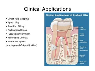 Mineral trioxide aggregate | PPT