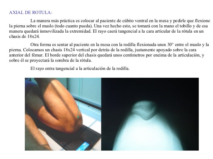 ManualRx07 MiembroInferior