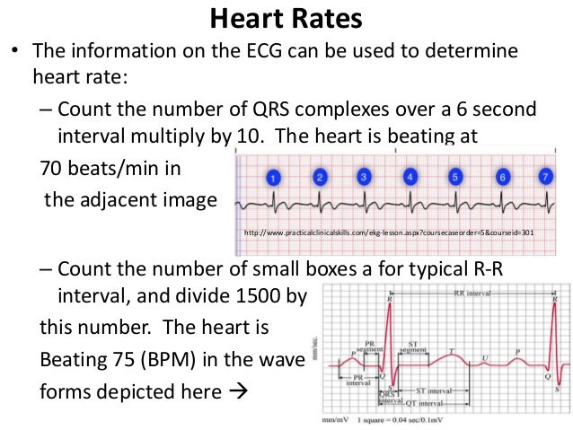 Electrocardiogram (ECG or EKG)