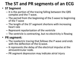 Electrocardiogram (ECG or EKG) | PPTX
