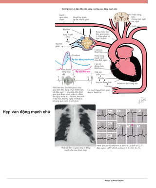 Minh họa hẹp/hở van tim | PDF