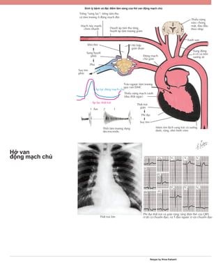 Minh họa hẹp/hở van tim | PDF