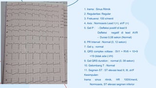 Contoh Mini-Cex_Kasus ACS STEMI Inferior.pptx