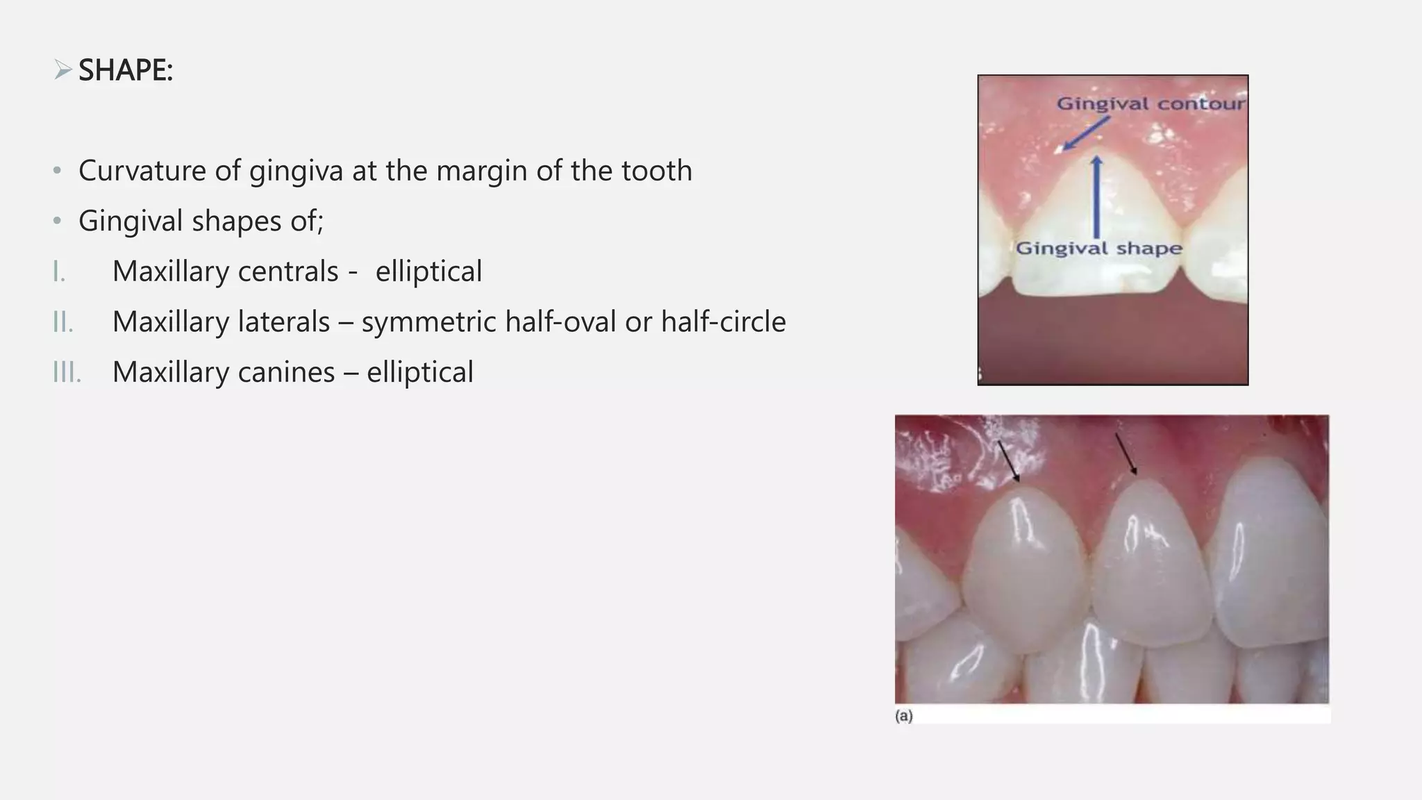 MINI-ESTHETICS AND MICRO-ESTHETICS.pptx