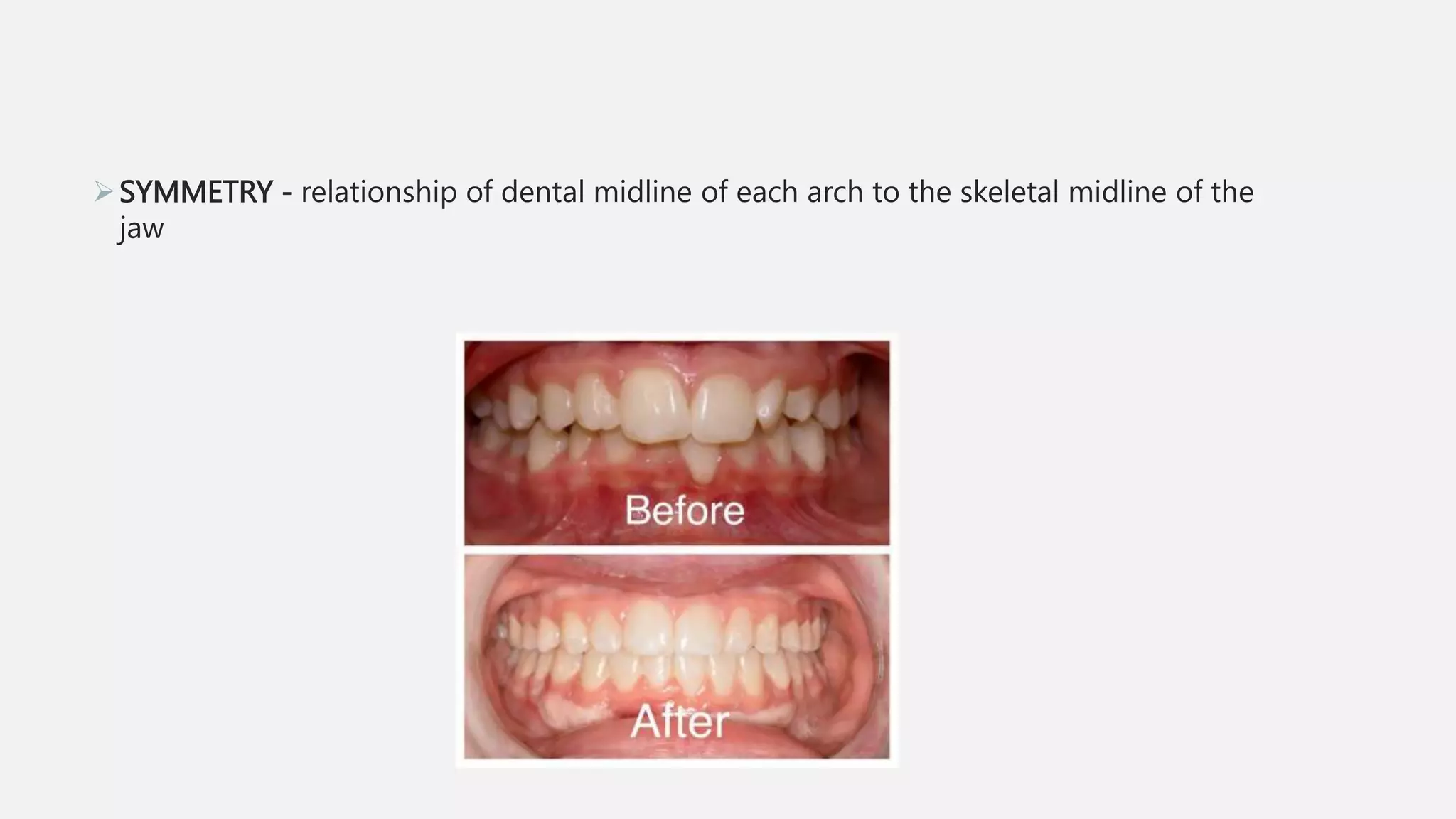 MINI-ESTHETICS AND MICRO-ESTHETICS.pptx