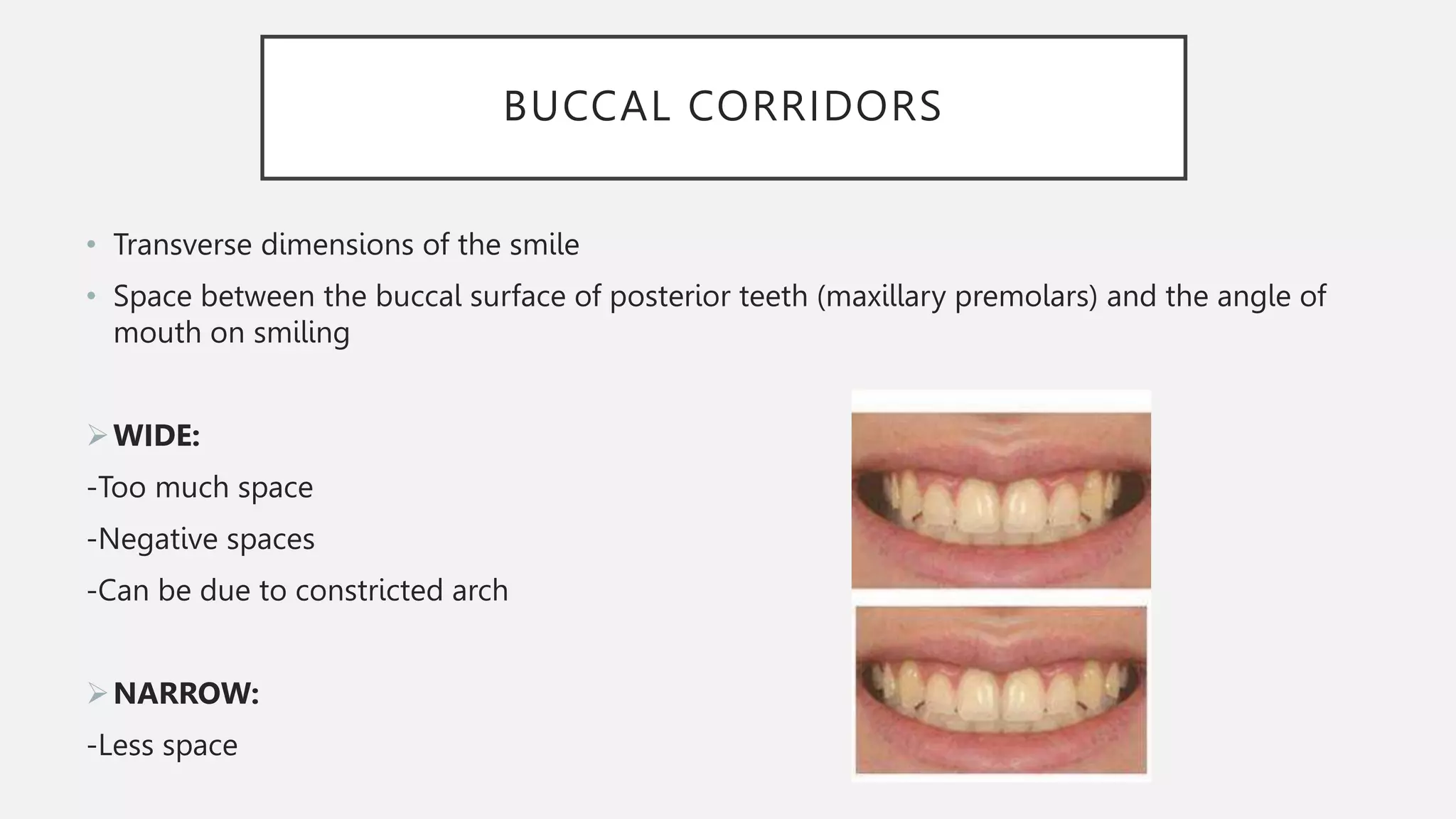 MINI-ESTHETICS AND MICRO-ESTHETICS.pptx