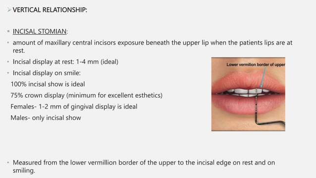 MINI-ESTHETICS AND MICRO-ESTHETICS.pptx | Dental Health | Diseases and ...