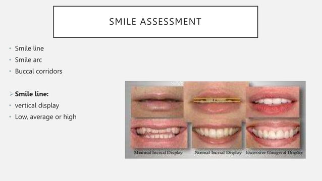 MINI-ESTHETICS AND MICRO-ESTHETICS.pptx | Dental Health | Diseases and ...