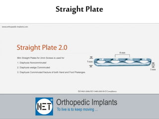 Hand and Foot Implants | PPTX