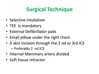 Minimal İnvaziv Aort Kapak Değişimi, | PPT