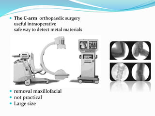 Application of Mini-C Arm in Oral & Maxillofacial Surgery | PPTX