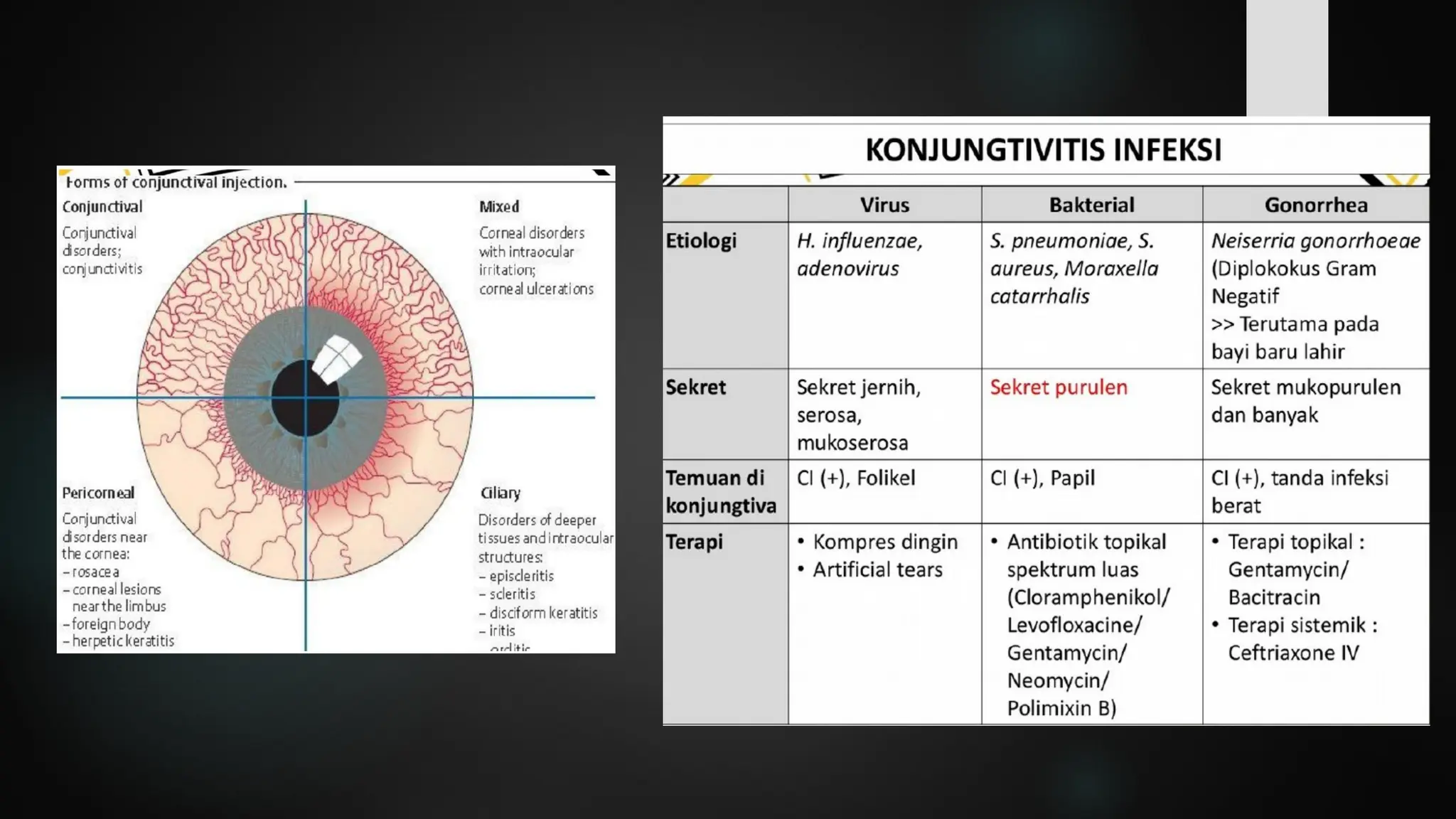 Mini Case_Diagnosis dan Tatalaksana Keratitis | PPTX