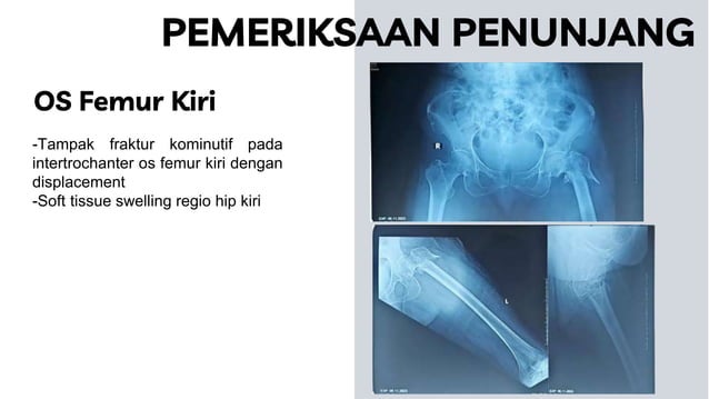 Mini CEX Orthopaedi Dimas.pptx