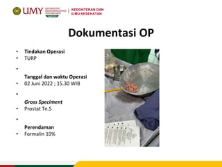 presentasi kasus benign prostat hiperplasia | PPTX