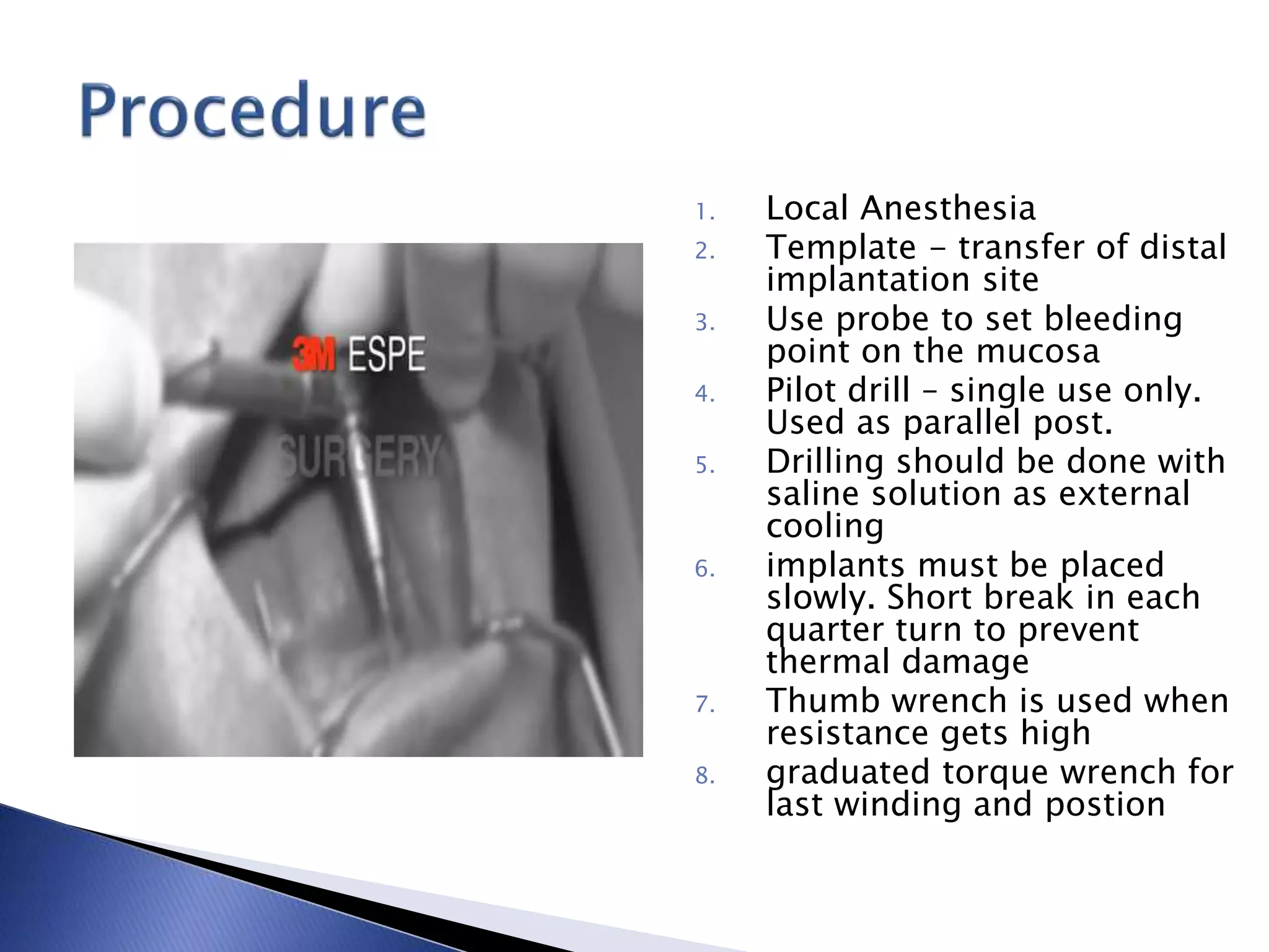 Mini dental implants | PPT