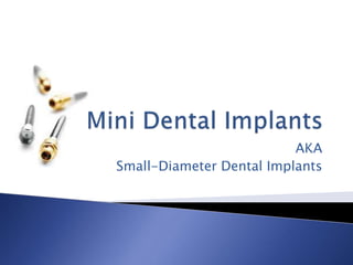 Mini dental implants | PPTX