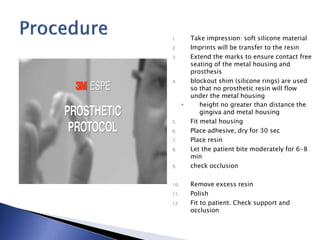 Mini dental implants | PPT