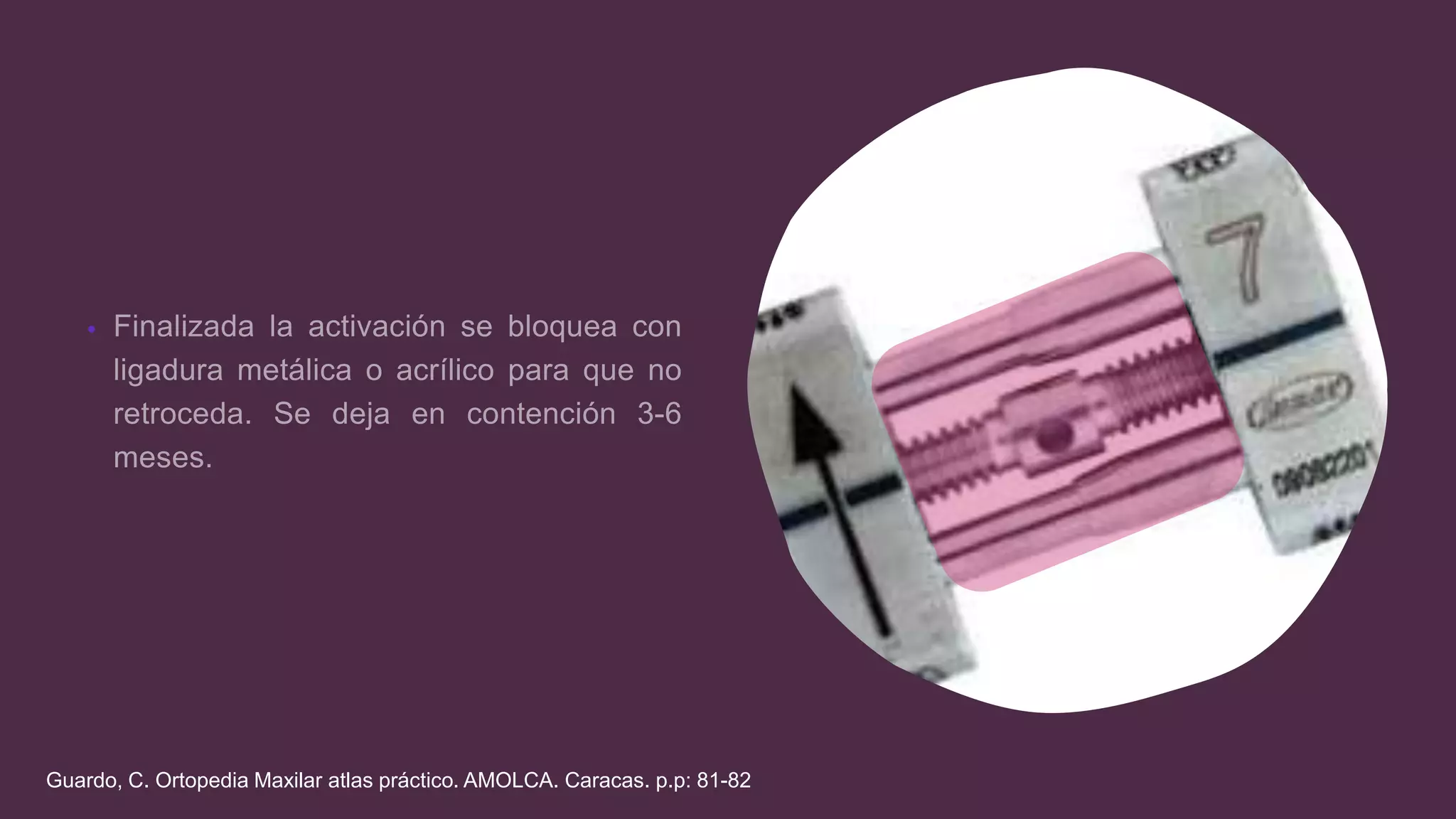 mini expander.pptx