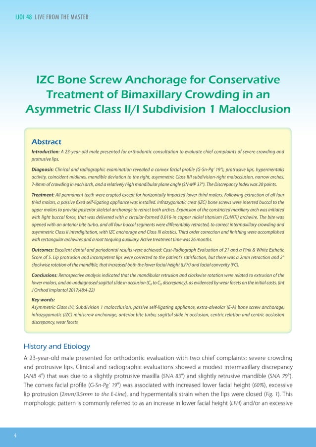 IZC Bone Screw Anchorage for Conservative Treatment of Bimaxillary ...
