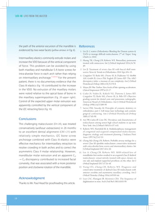 IZC Bone Screw Anchorage for Conservative Treatment of Bimaxillary ...