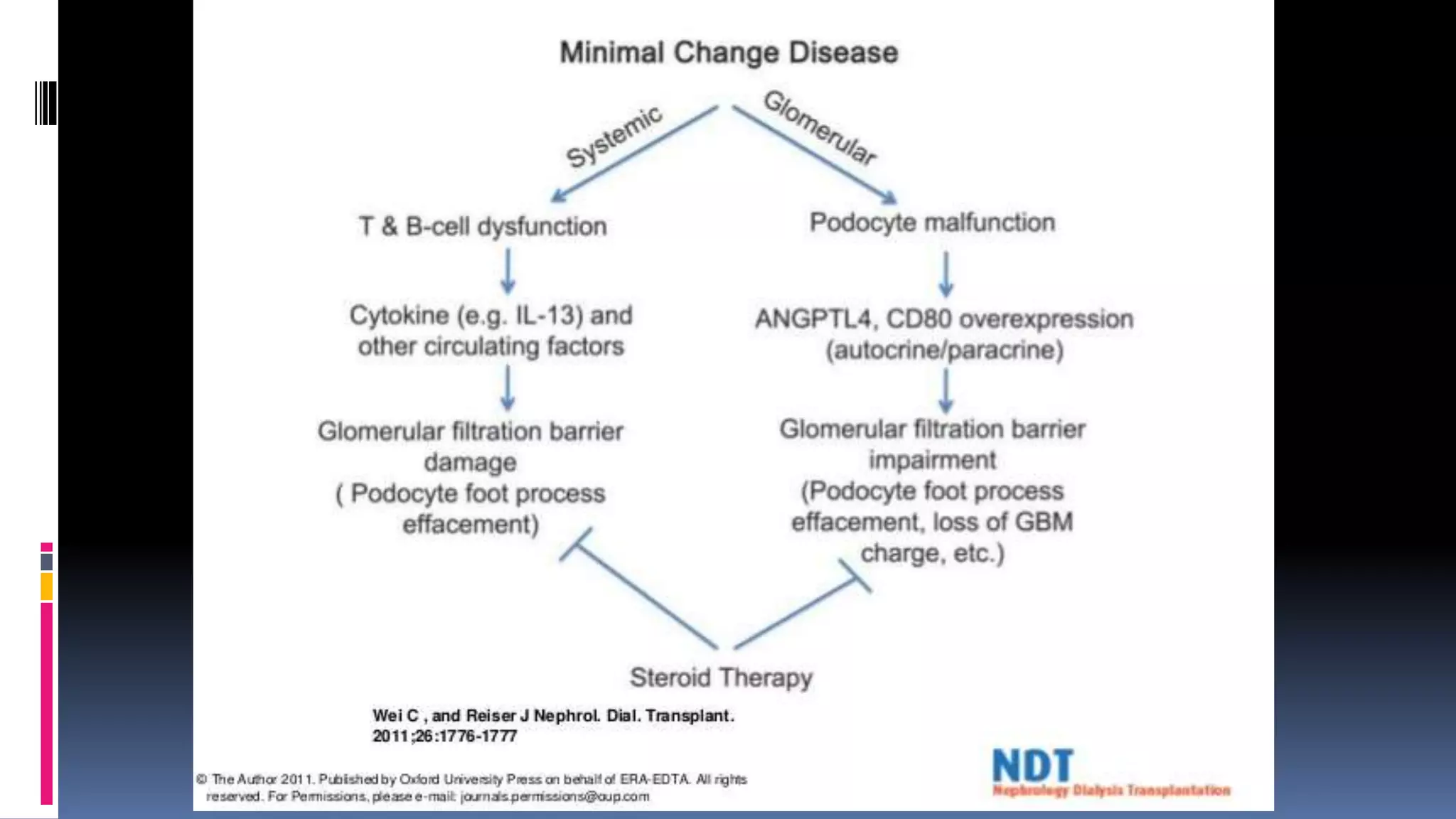 Minimal change disease | PPTX