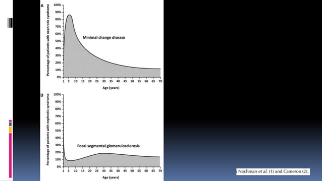 Minimal change disease | PPTX