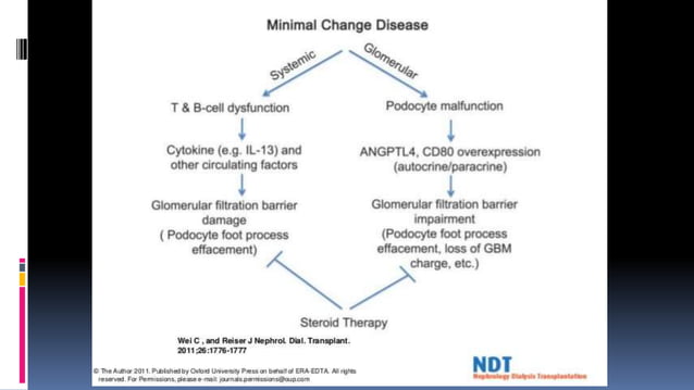 Minimal change disease | PPTX