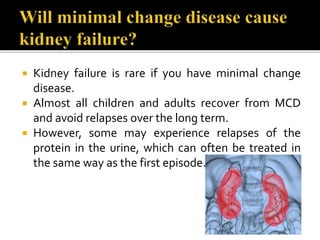 Minimal change disease | PPTX | Diseases and Conditions | Medical Health