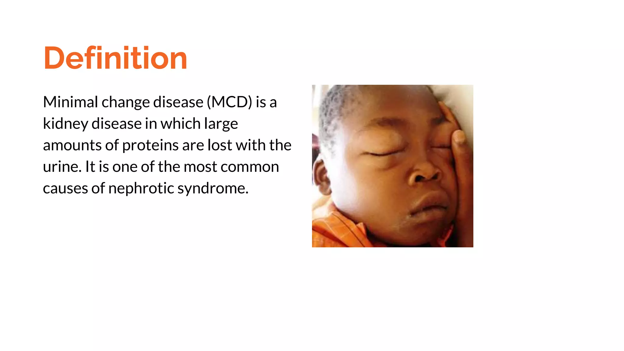 Minimal Change Disease.pptx | Diseases and Conditions | Medical Health