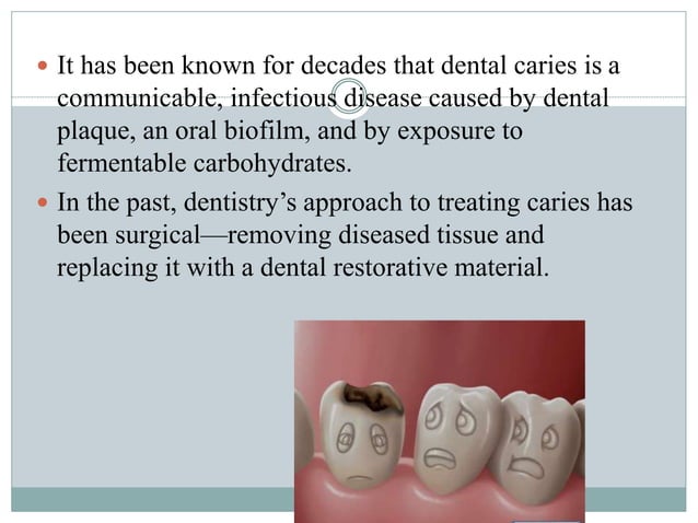 Minimal intervention dentistry | PPTX