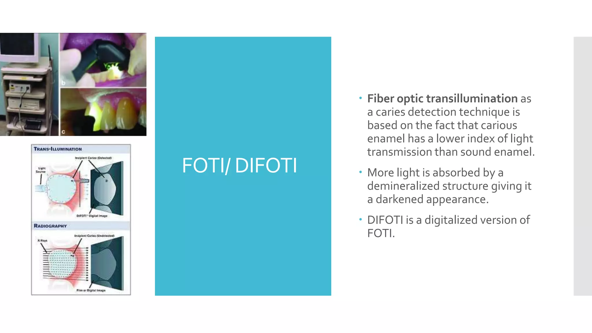 Minimal intervention dentistry | PPTX