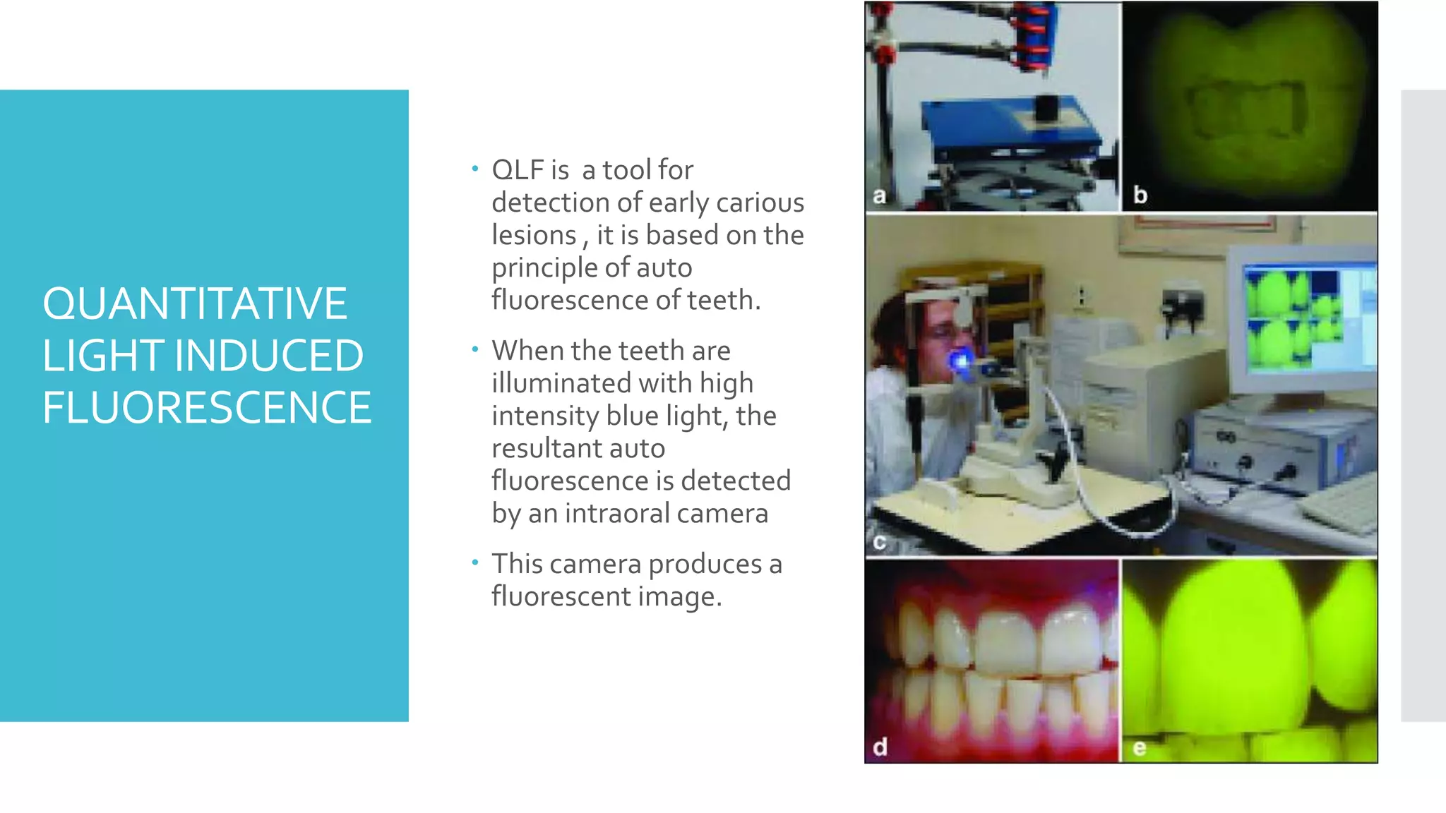 Minimal intervention dentistry | PPTX