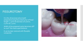 Minimal intervention dentistry | PPTX