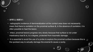 Minimal invasive dentistry | PPTX
