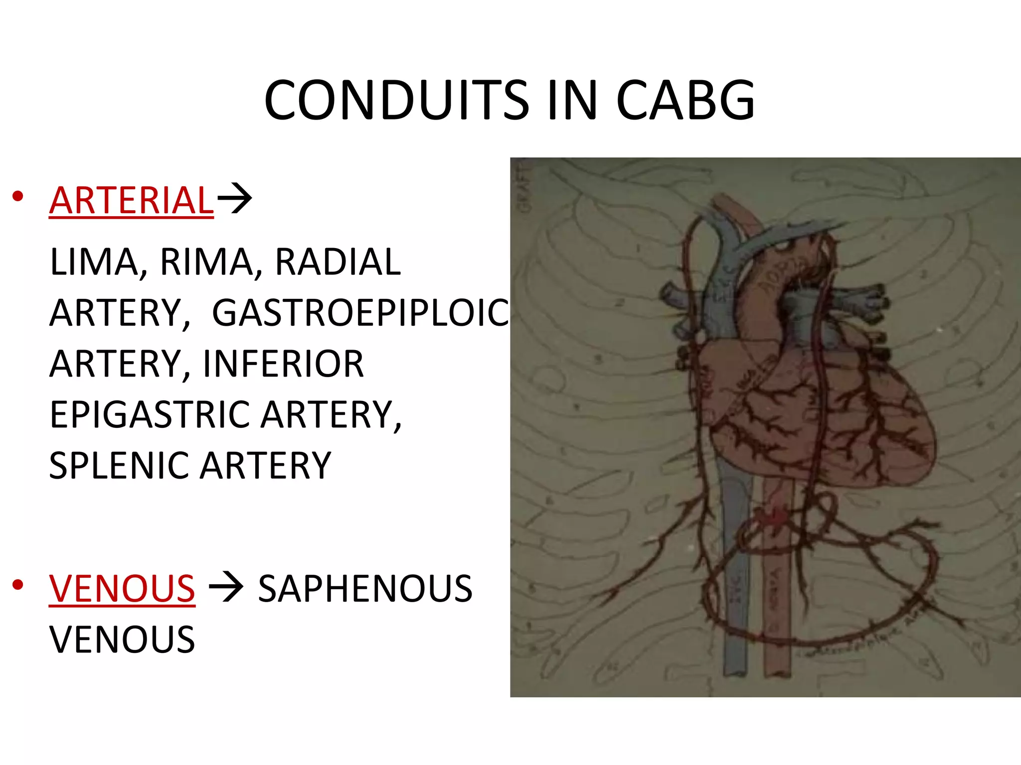 Minimal invasive cabg | PPT