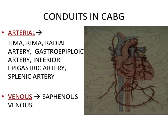Minimal invasive cabg