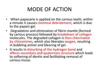 Minimal Invasive Dentistry (MID) | PPTX