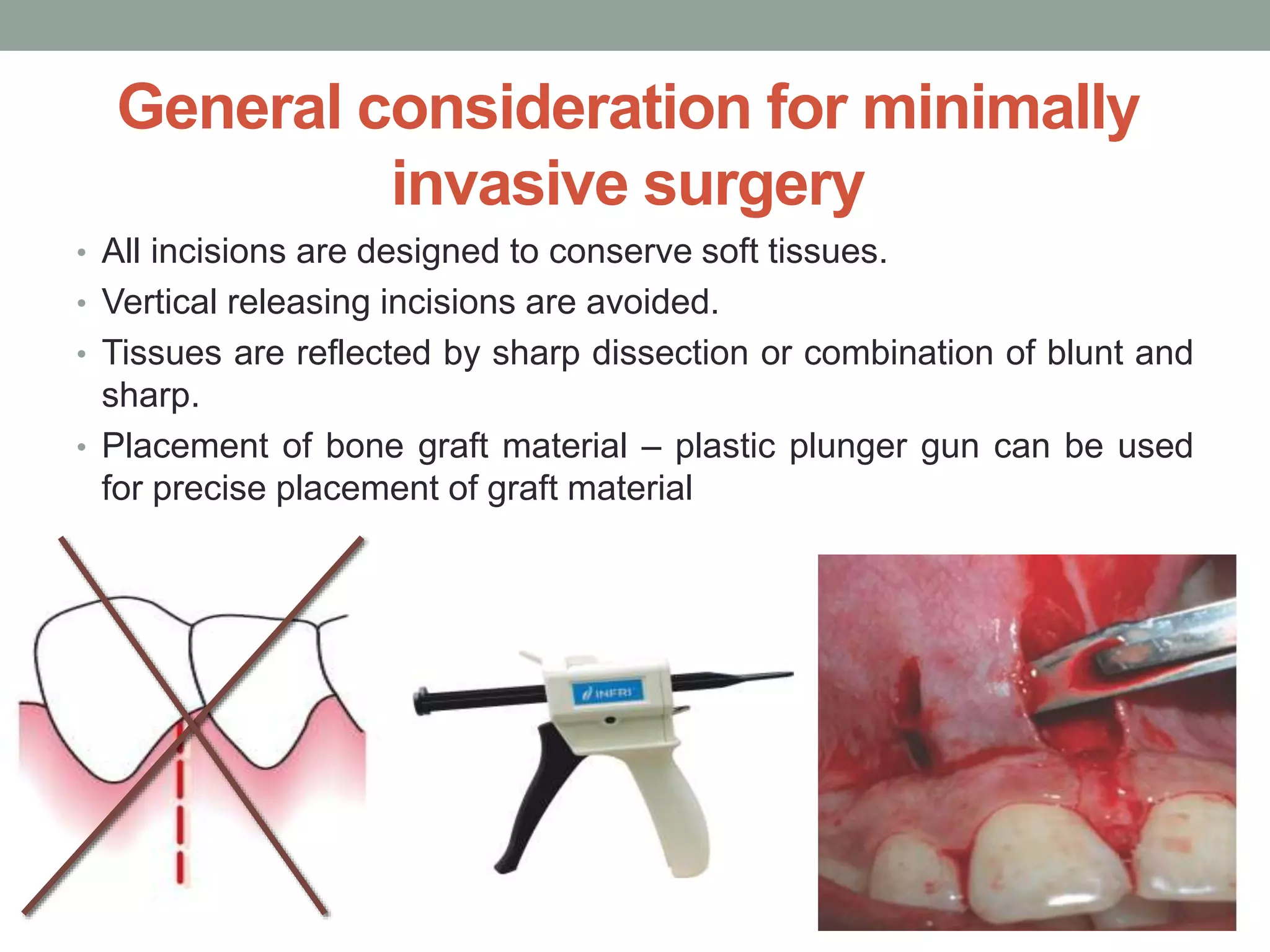 Minimal invasive techniques | PPTX