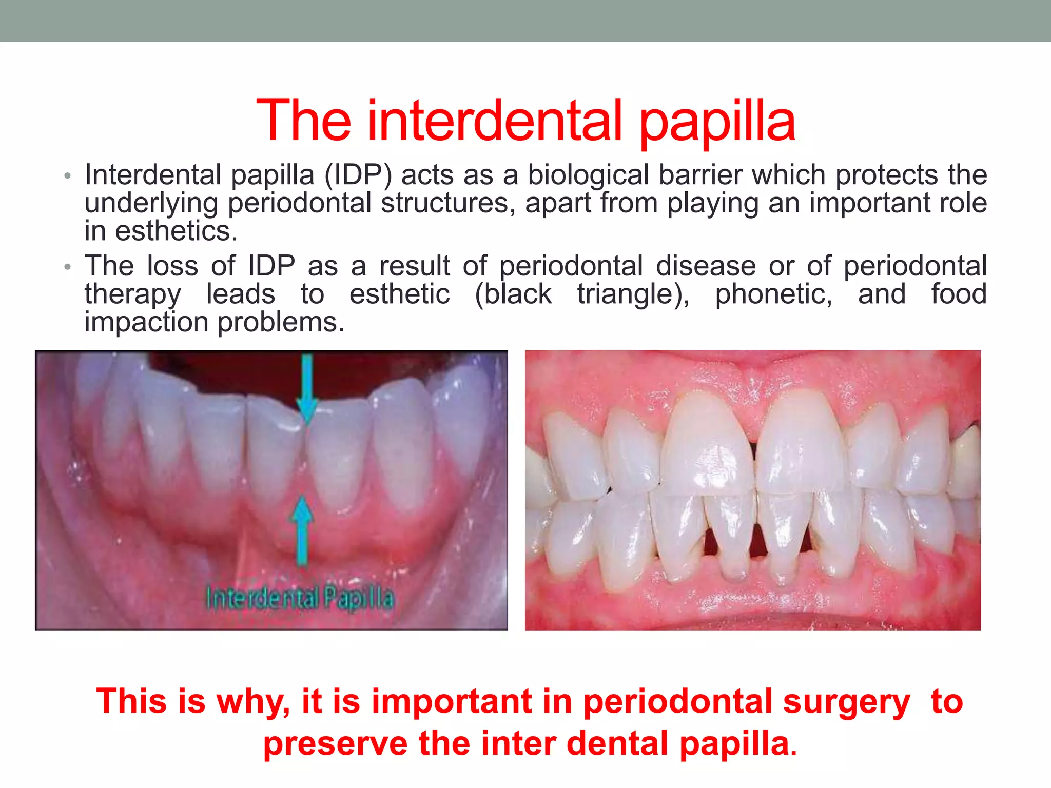 Minimal invasive techniques | PPTX