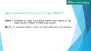 Minimally Invasive Spine Surgery | Sri Balaji Action Medical Institute ...