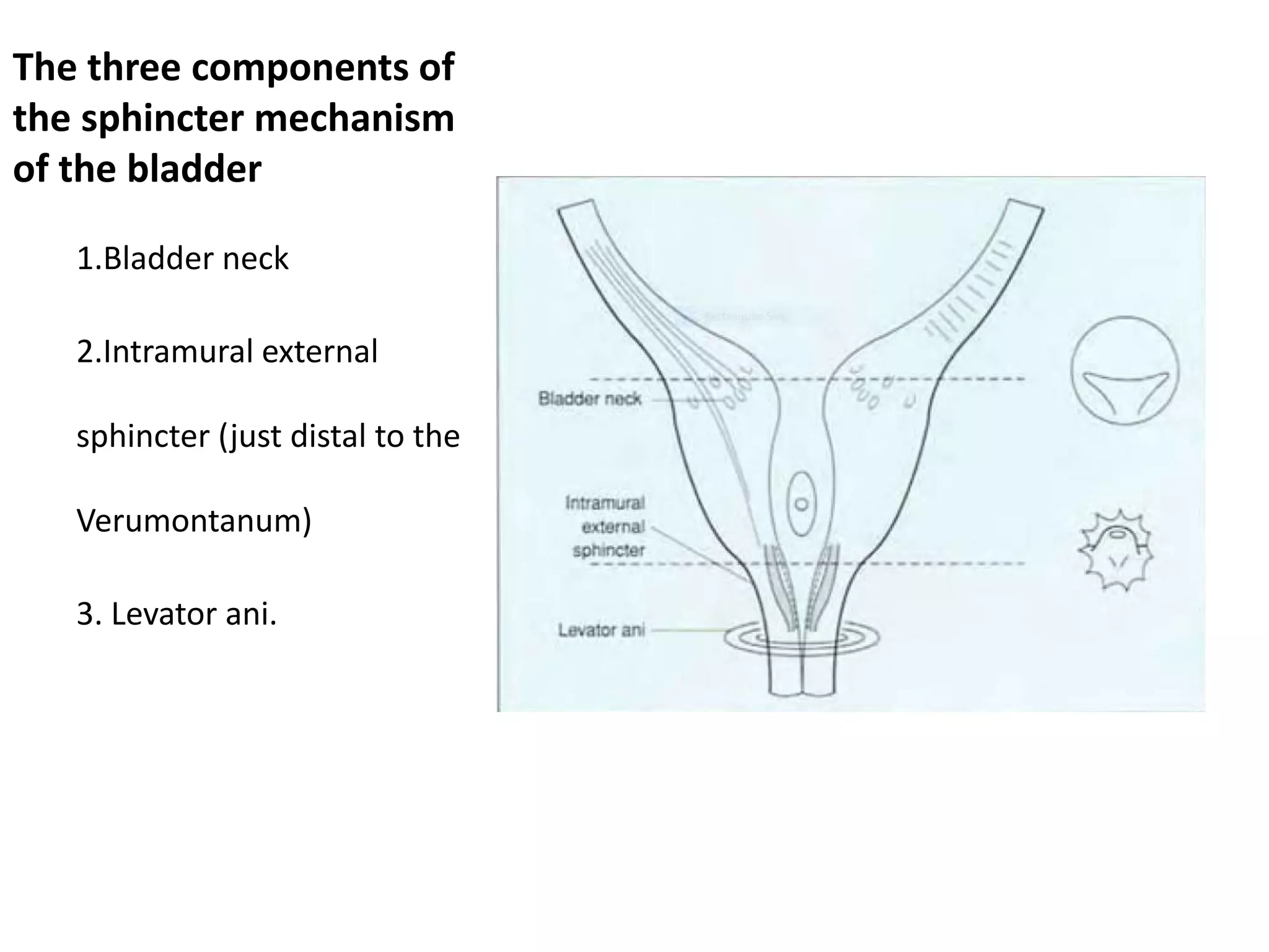 Minimally invasive and endoscopic management of benign prostatic | PPTX