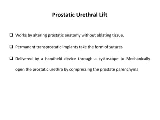 Minimally invasive and endoscopic management of benign prostatic | PPTX