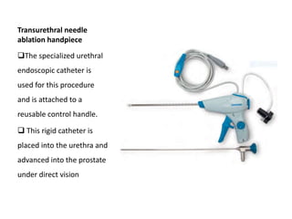 Minimally invasive and endoscopic management of benign prostatic | PPTX
