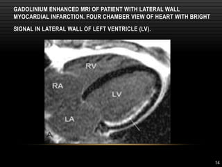 MINIMALLY_INVASIVE_AUTOPSY (post mortem).ppt
