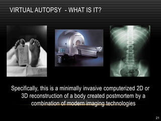 MINIMALLY_INVASIVE_AUTOPSY (post mortem).ppt
