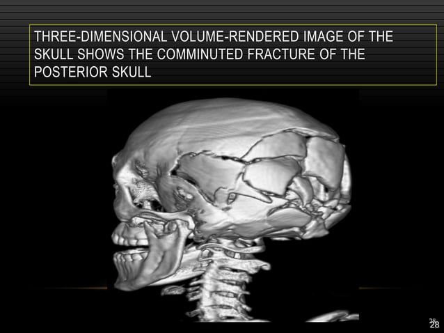 MINIMALLY_INVASIVE_AUTOPSY (post mortem).ppt | Death, Injury, or ...
