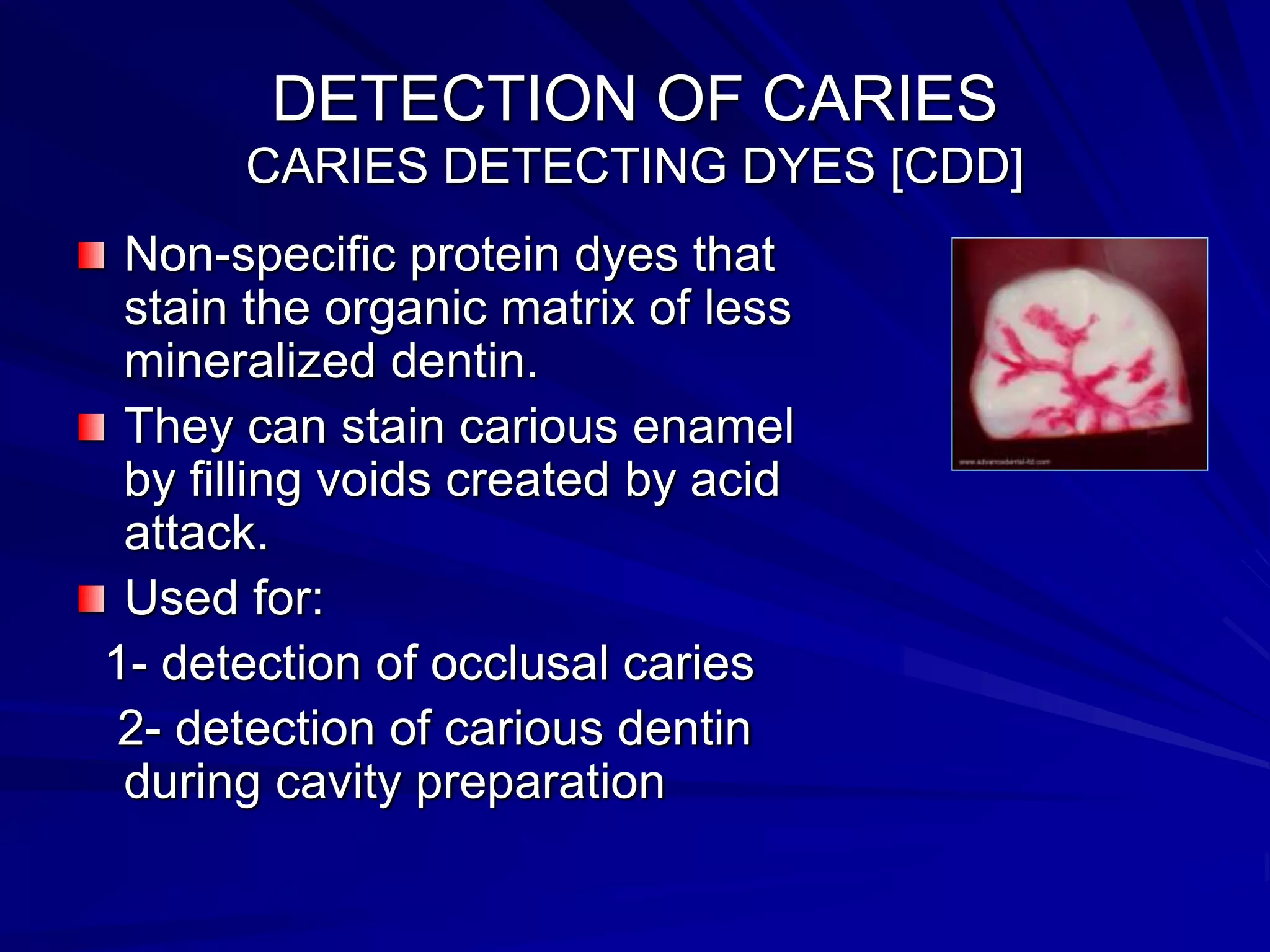 Minimally invasive caries therapy | PPT